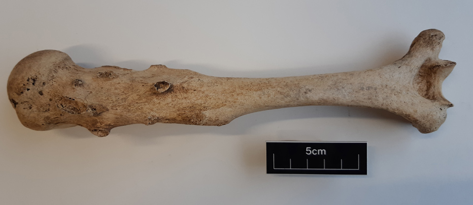 Genetic causes of bone tumours discovered in 1,000-year-old Irish ...