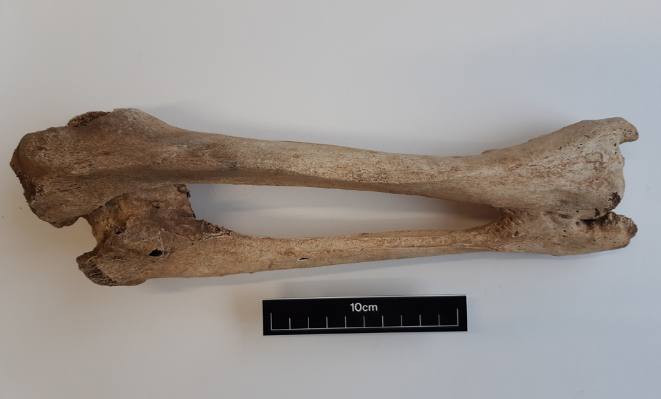 Genetic causes of bone tumours discovered in 1,000-year-old Irish ...
