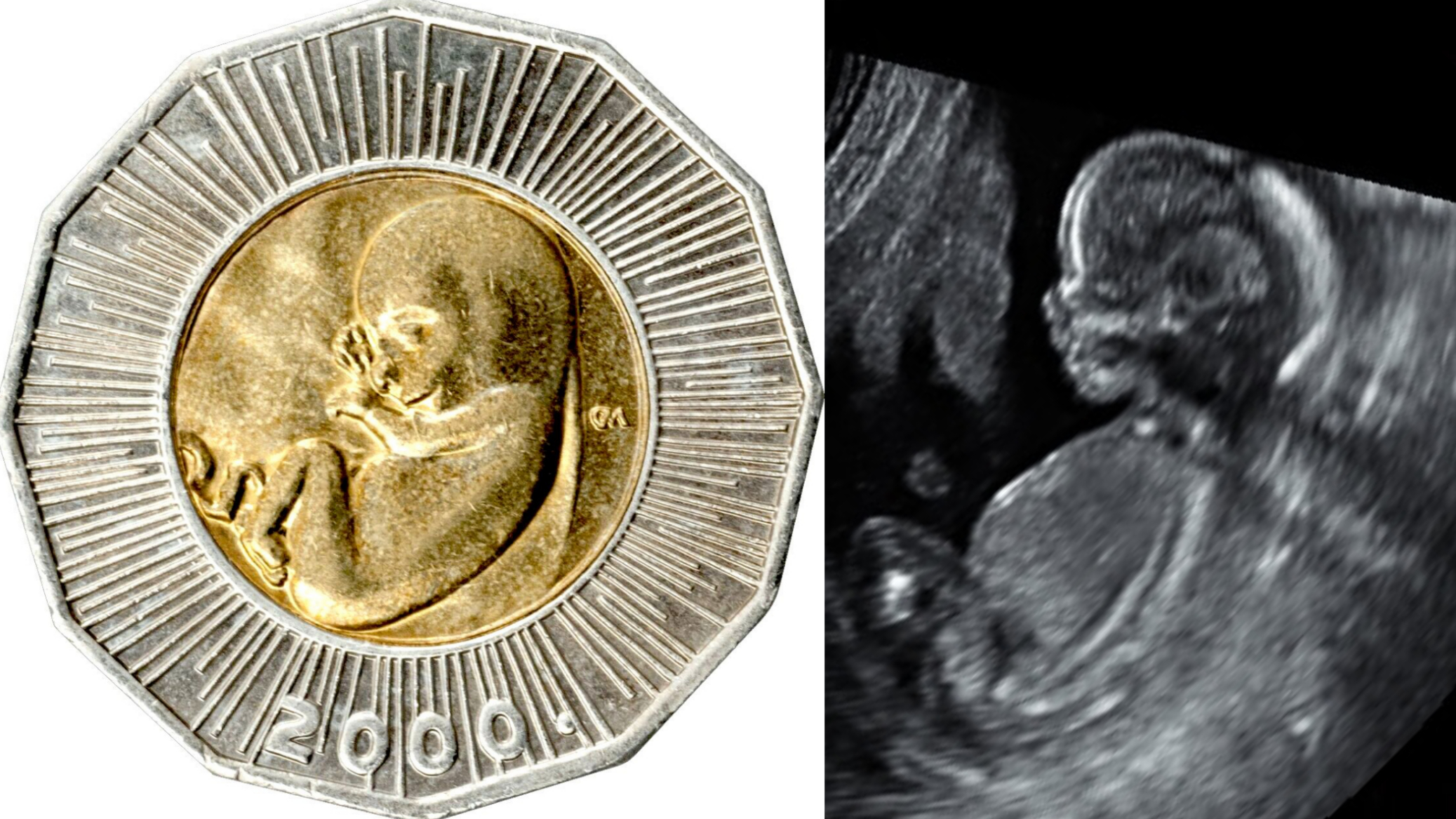 Why Croatia minted an official coin featuring an unborn baby - Gript