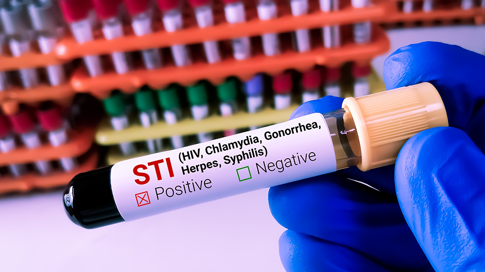 STI infections in Ireland are up in 2023 - Gript