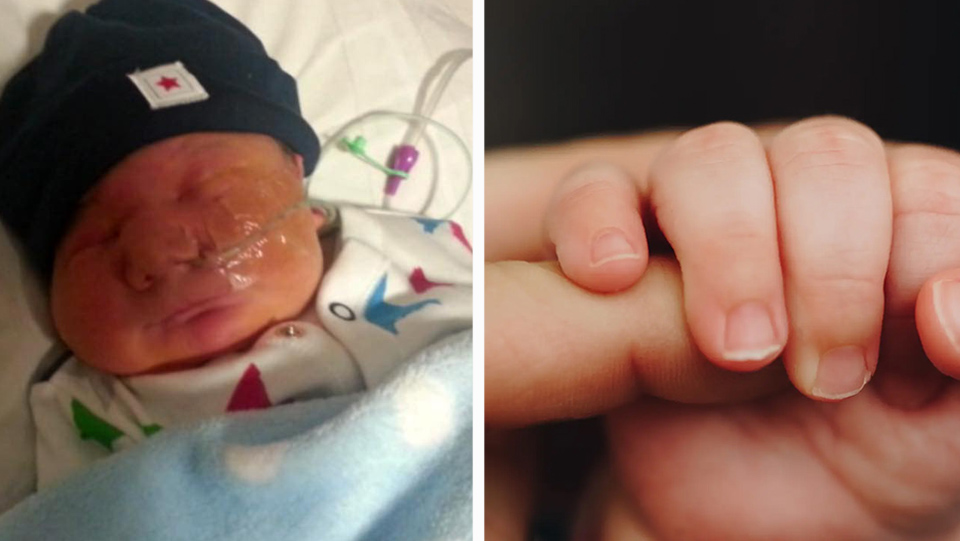 Trisomy 13 babies: new study shows increased life span, points to ...