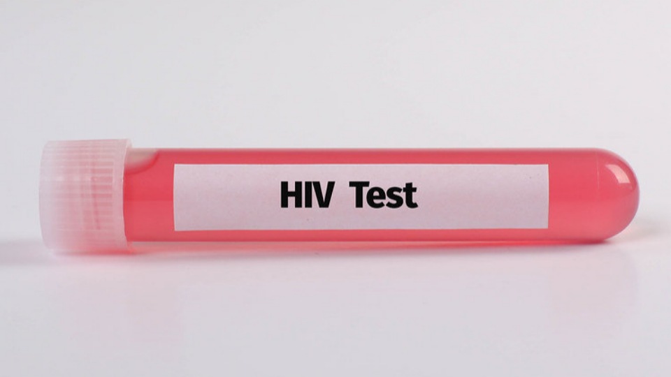 74% of HIV diagnoses among people born outside Ireland - Gript