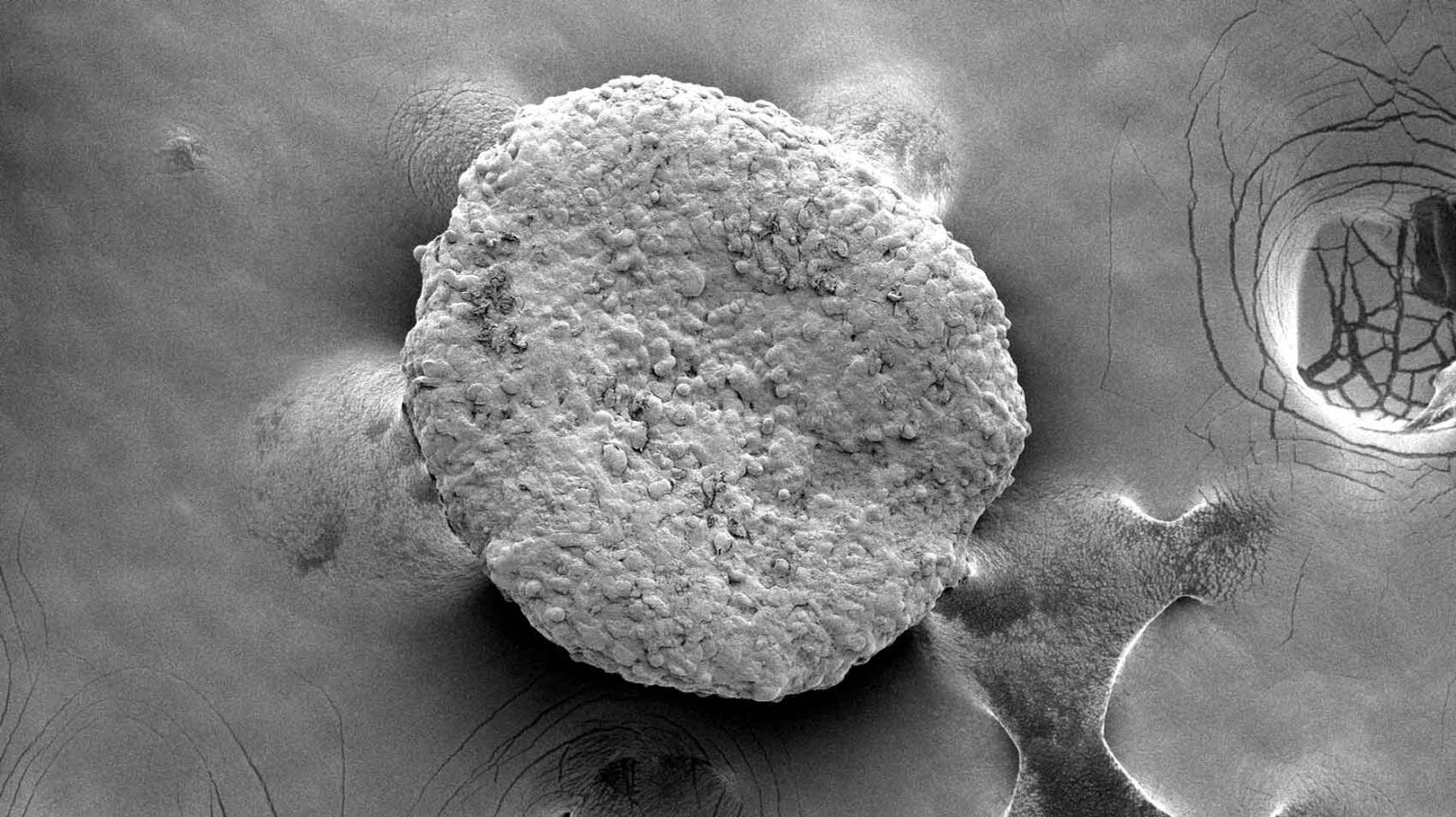 Hungry Fat Cells Could Someday Starve Cancer to Death - Gript