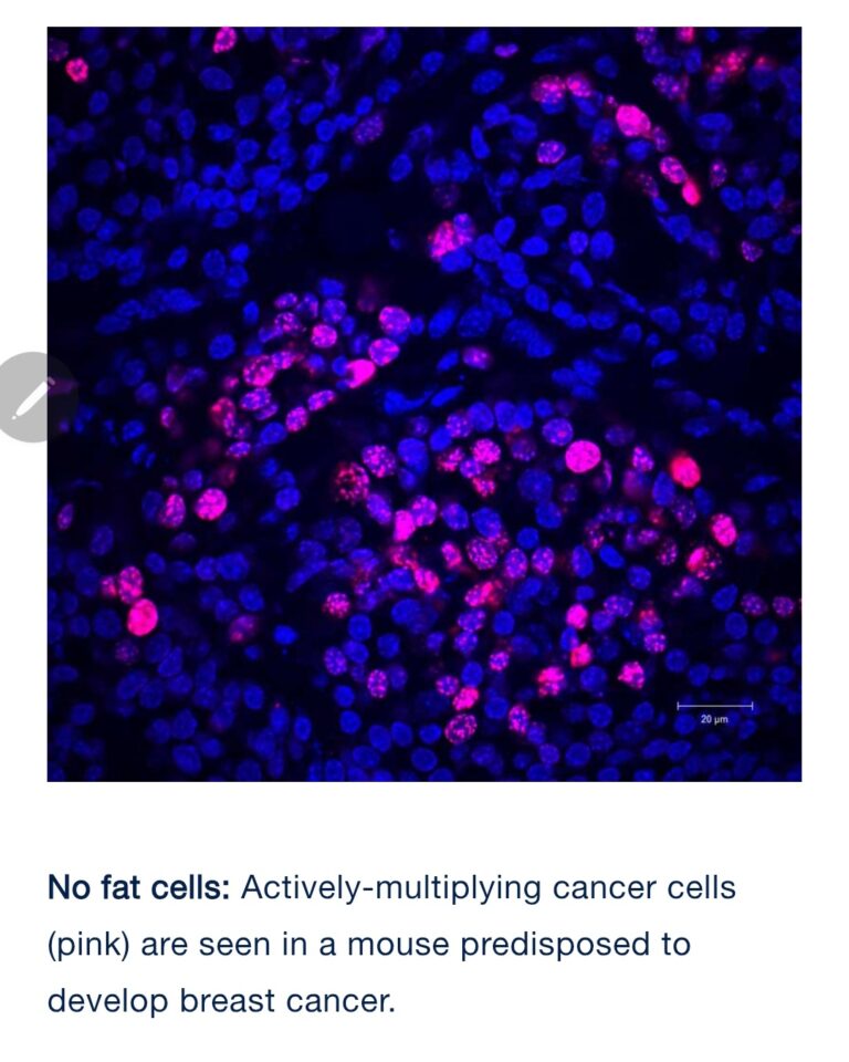 Hungry Fat Cells Could Someday Starve Cancer to Death - Gript
