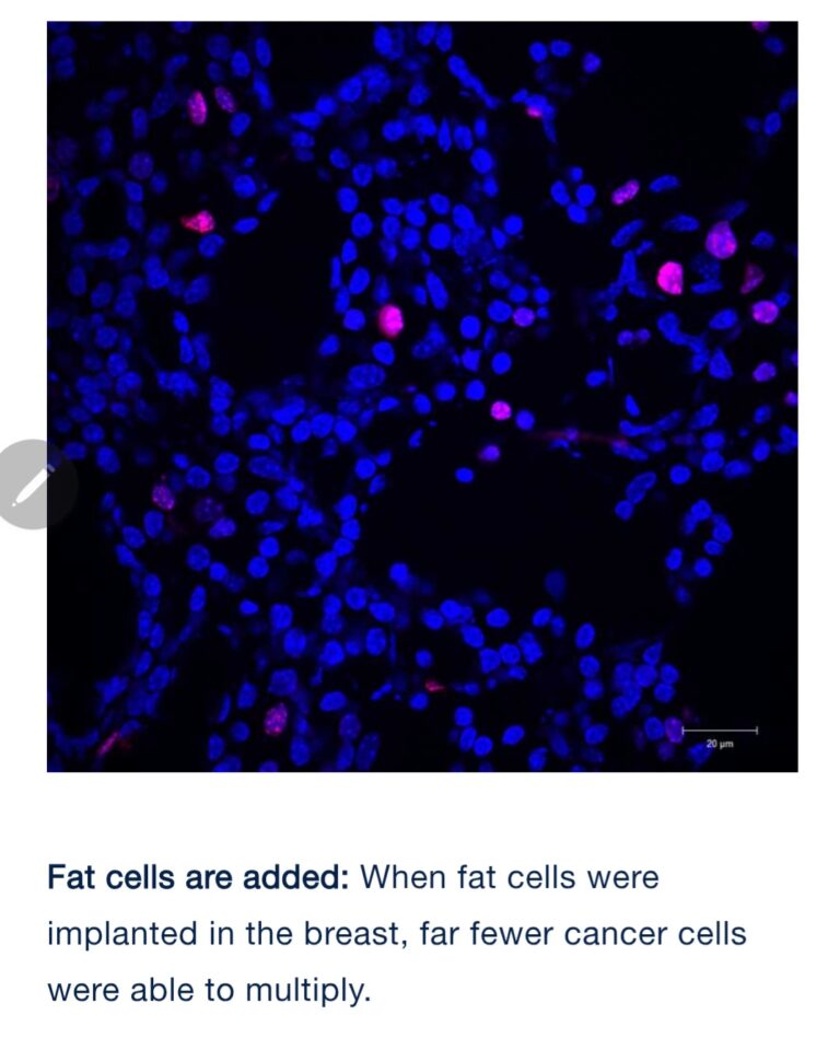 Hungry Fat Cells Could Someday Starve Cancer to Death - Gript